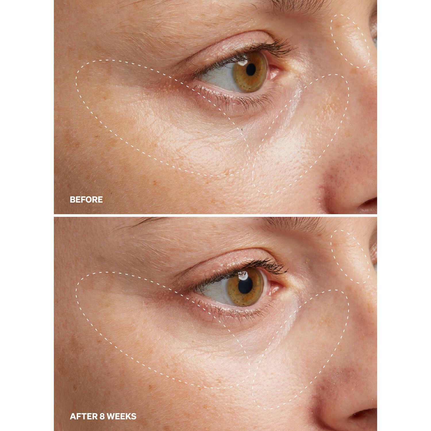Megadose Sérum, HPR-Retinoid 0.3% - Onélogy | MyOrigines Parapharmacie ...