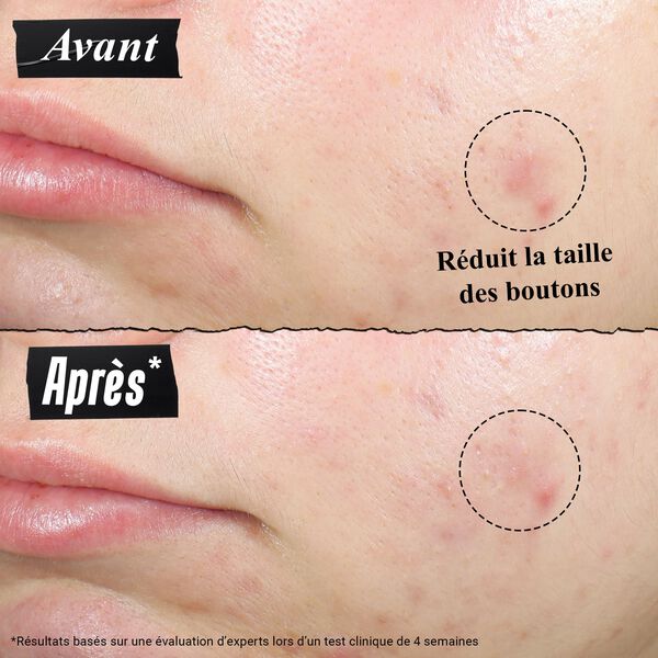 Truly Targeted Blemish Clearing Solution | MyOrigines Produit