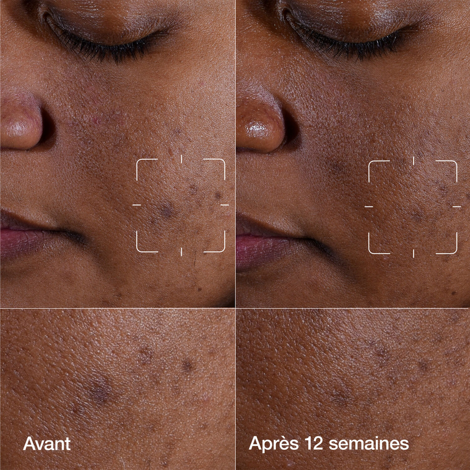 Even Better Clinical™, Sérum Illuminateur Anti-taches - Clinique ...