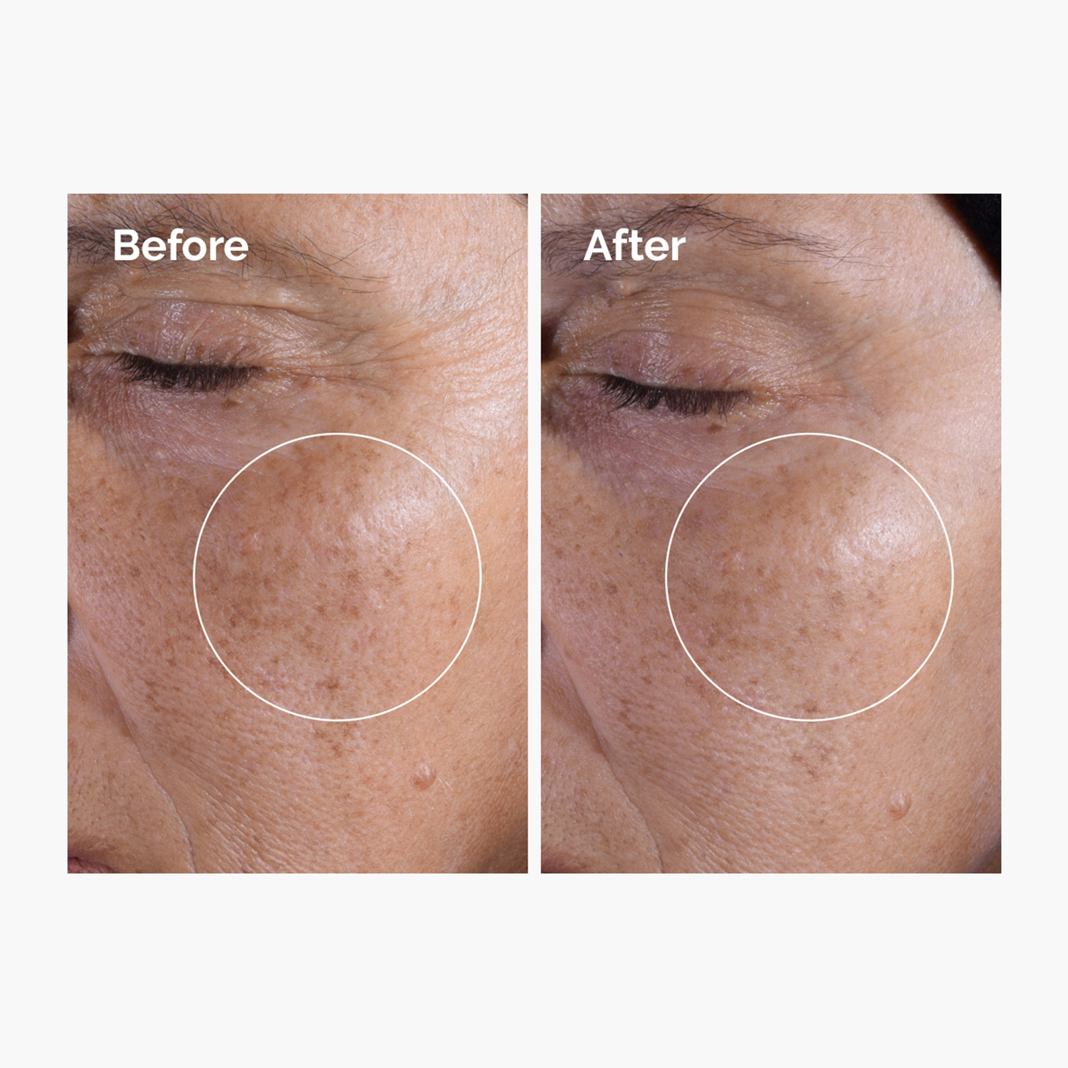 Tonique Exfoliant à l’Acide Glycolique 7%, Lotion Exfoliante Acide ...